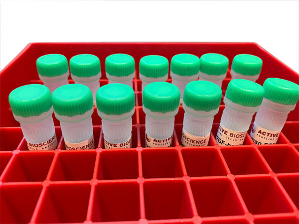 Human Plasmin (Plasma) Enzyme from Active Bioscience